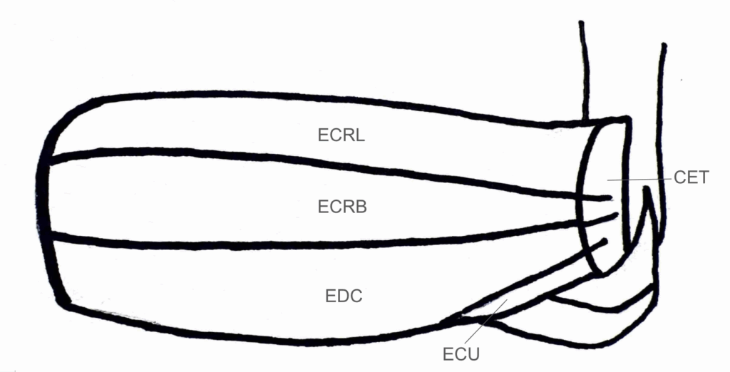 Non-operative Management Strategies for Lateral Epicondylitis: A ...